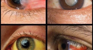 “What Your Eyes Reveal About Hidden Diseases—Don’t Ignore These Signs!” – LaptopsVilla